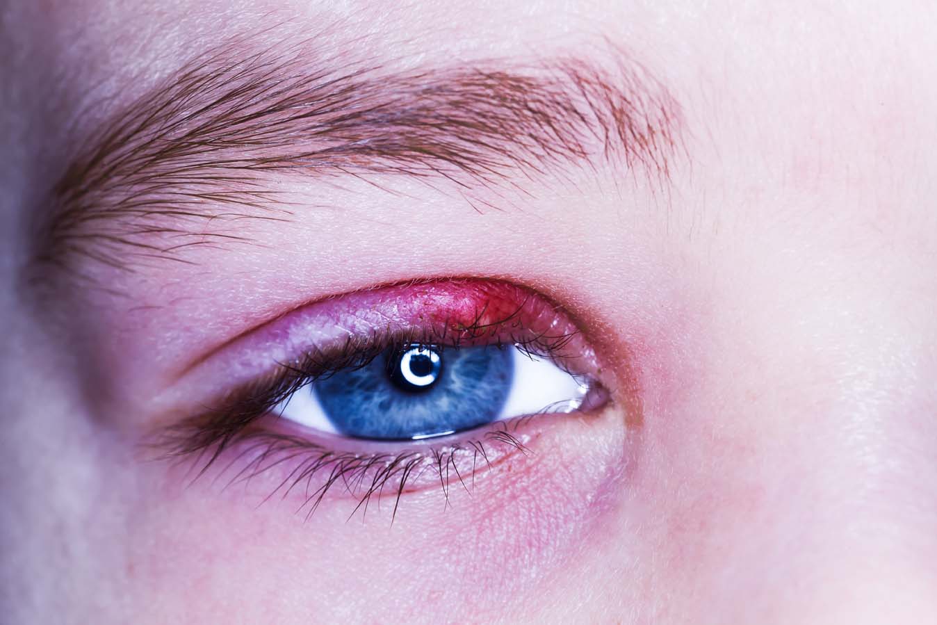 Eye Mask for Dry Eyes - Hot & Cold Therapy Eye Mask from I-MED Pharma