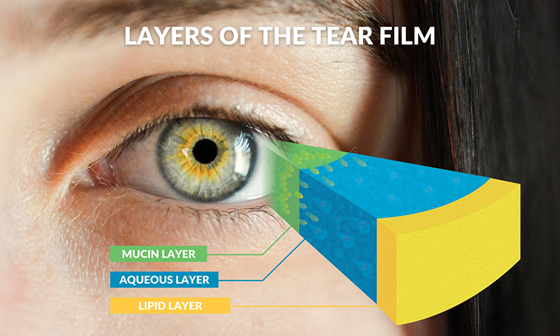 Aqueous Deficient vs. Evaporative Dry Eye: What’s the Difference?